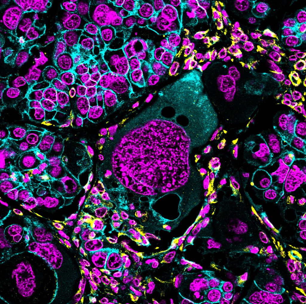 Unveiling the Intricacies of Polyploid Cells: A Key to... - PRAI NEWS